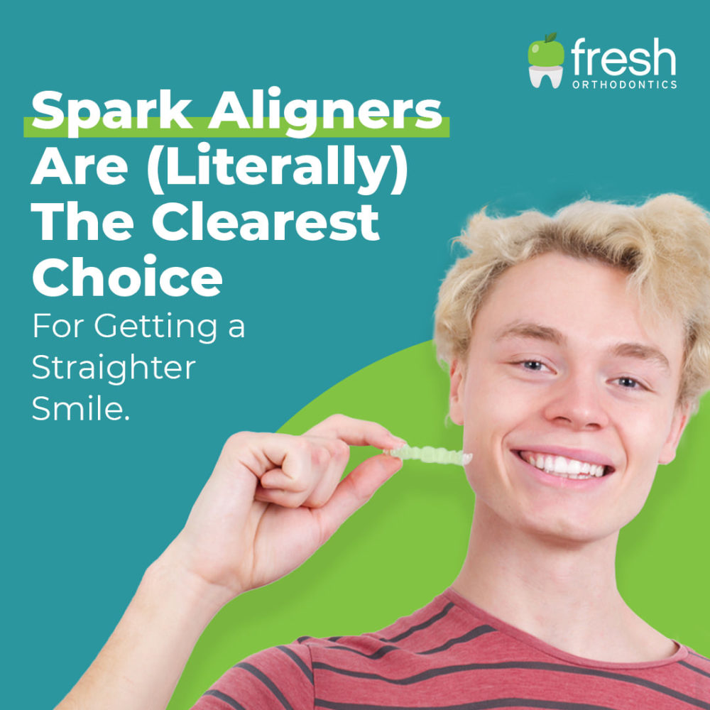 A Guide to Straightening Your Teeth With Spark Aligners